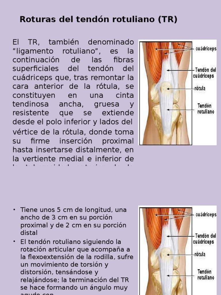 Roturas del Tendón Rotuliano | PDF | Rodilla | Sistema musculoesquelético