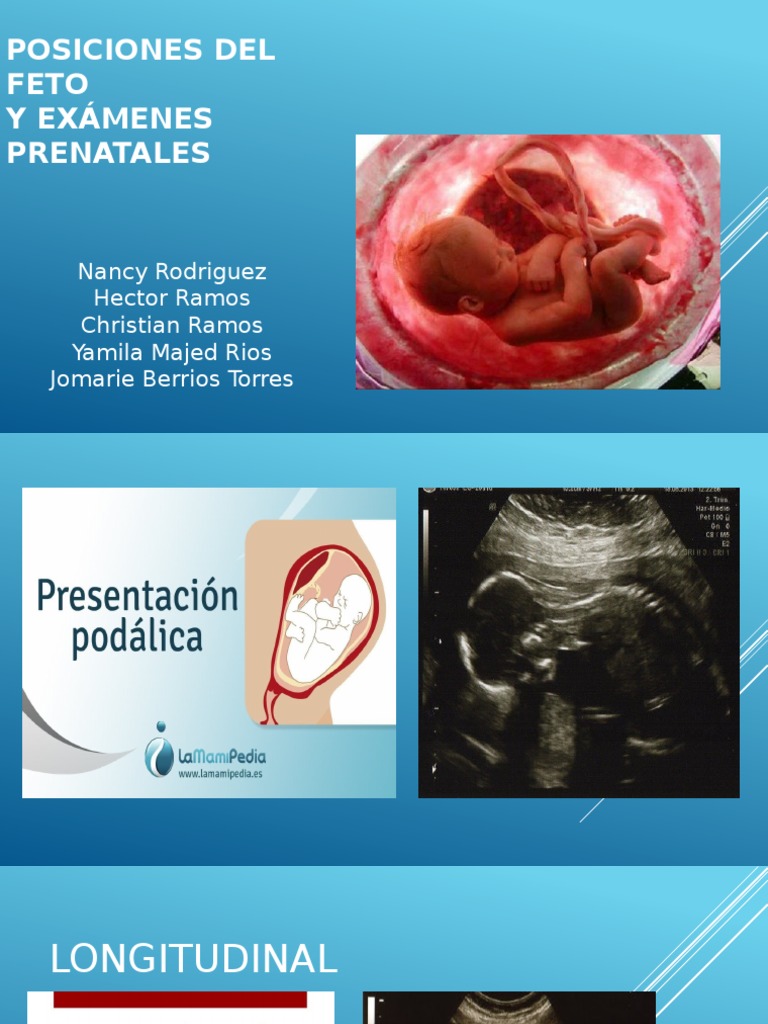Posiciones Del Feto | PDF