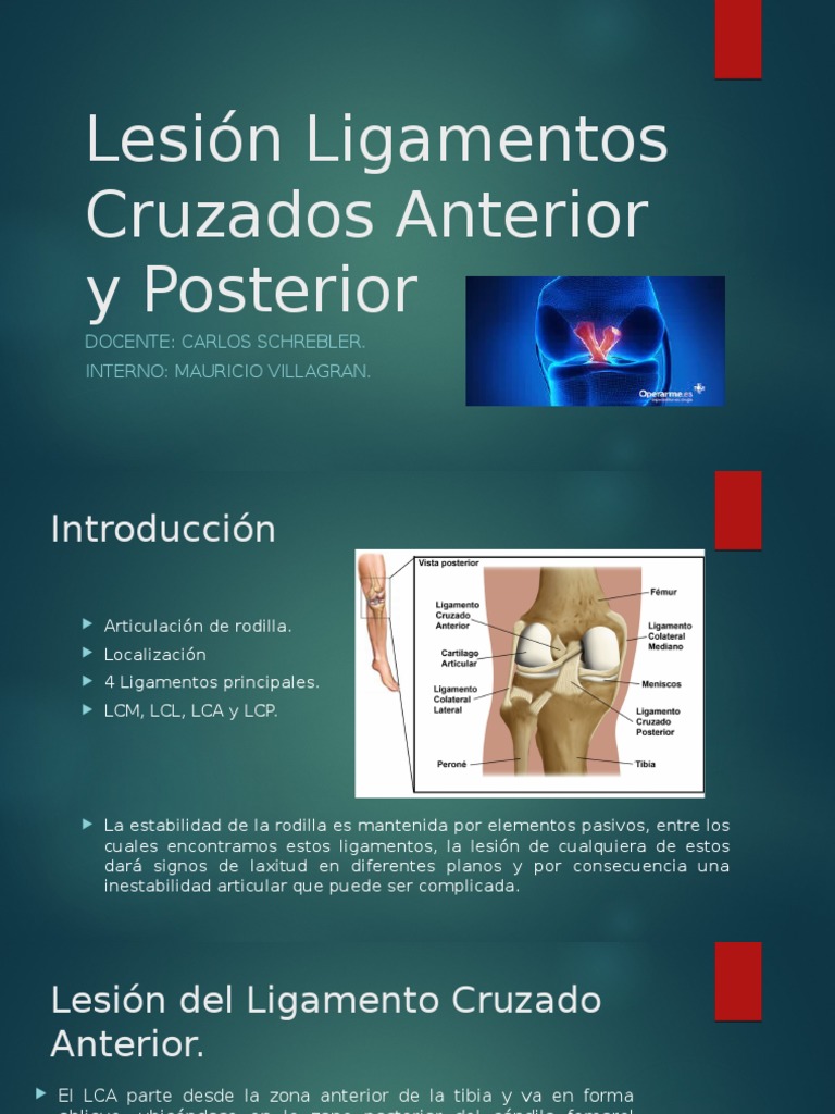 Lesión y Tratamiento del LCA y LCP | PDF | Rodilla | Sistema ...