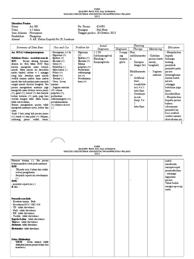 Pomr Irna-Subkonjungtival Bleeding+konjungtivitis | PDF | Sains & Matematika