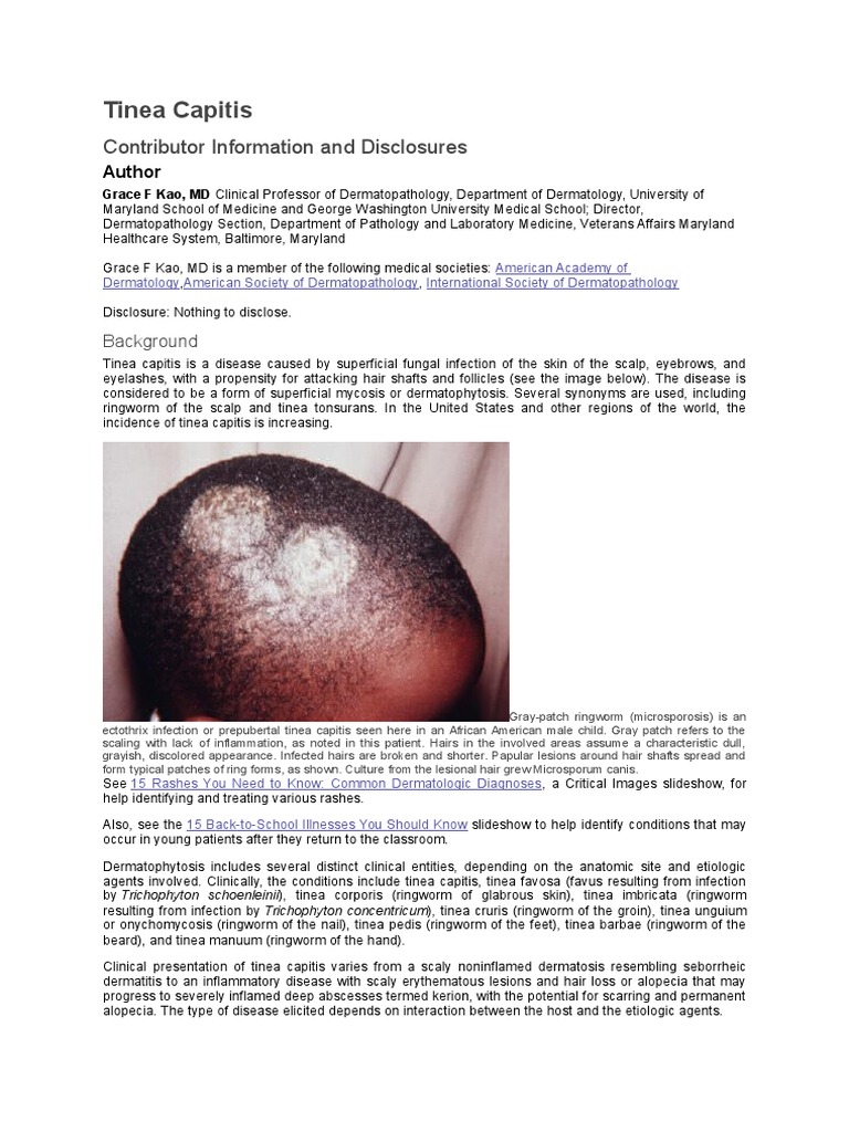 Tinea Capitis Emedicine | PDF | Infection | Medical Specialties