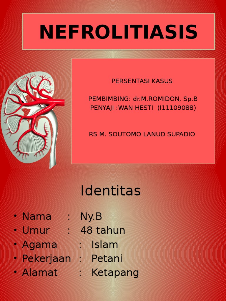 Laporan Kasus Nefrolitiasis Fix Hesti | PDF | Sains & Matematika