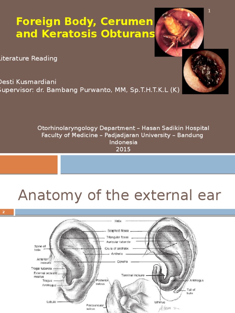 Foreign Body Ear | PDF | Medical Specialties | Health Sciences