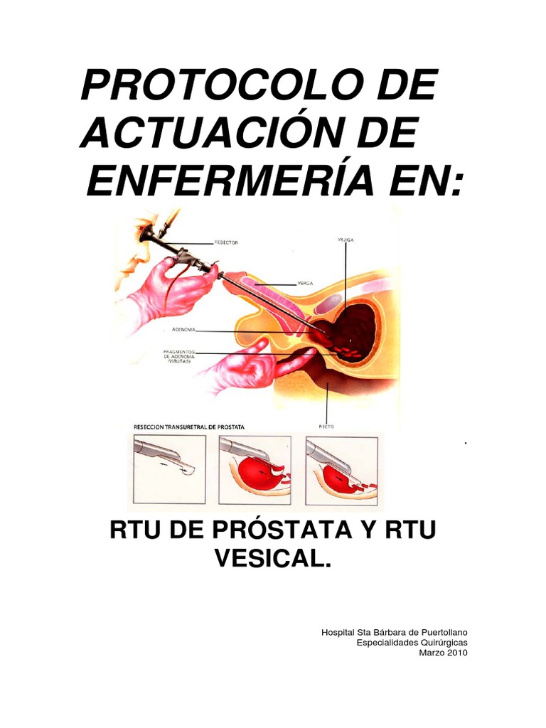 Protocolo Enfermería RTU Próstata/Vejiga | PDF | Vejiga urinaria | Urología