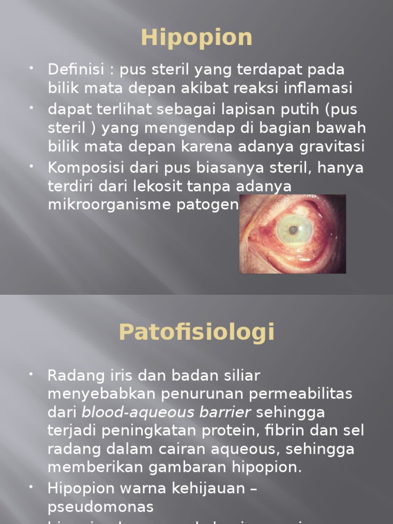 Definisi dan Penanganan Hipopion Mata | PDF