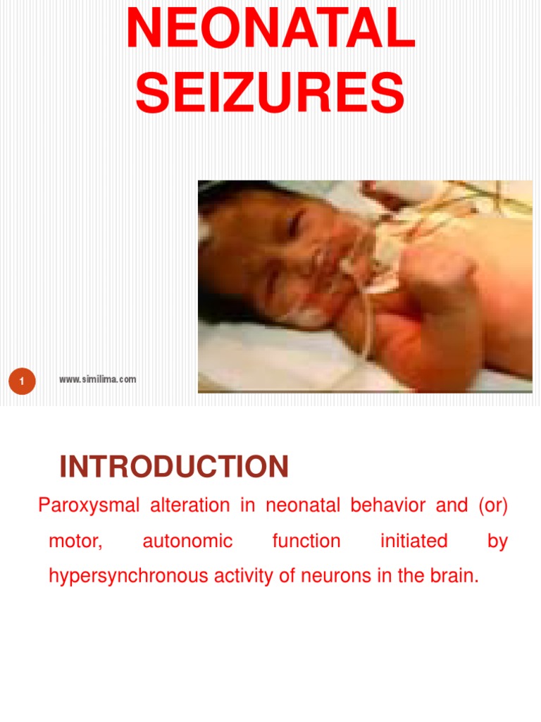 Neonatal Seizures | PDF | Electroencephalography | Epilepsy
