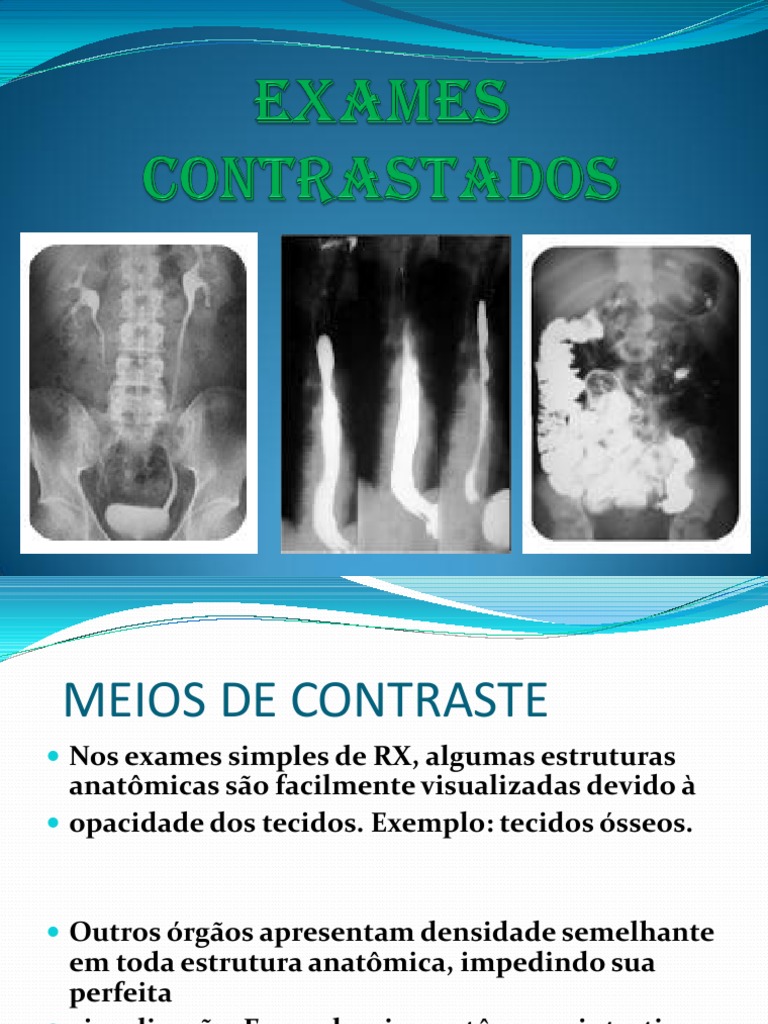 EXAMES CONTRASTADOS | Especialidades Médicas | Remédio
