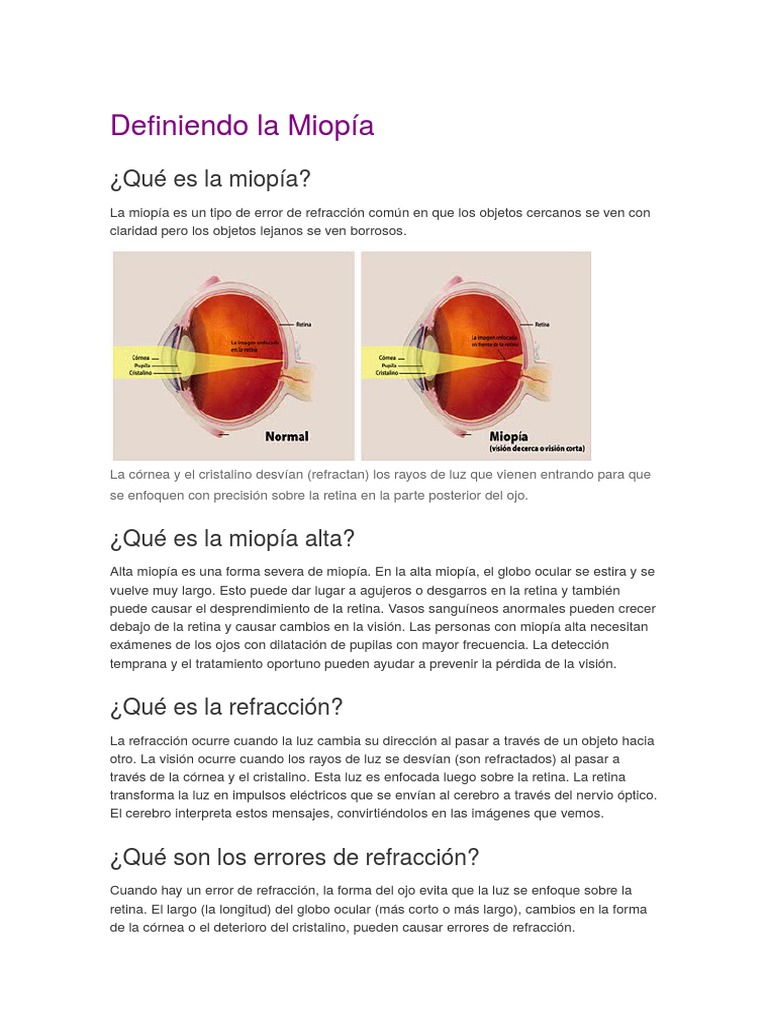 Miopía | PDF | Ojo humano | Percepción visual