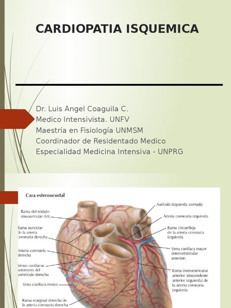 Fisiopatologia - Cardiopatia Isquémica | Electrocardiografia | Arritmia ...