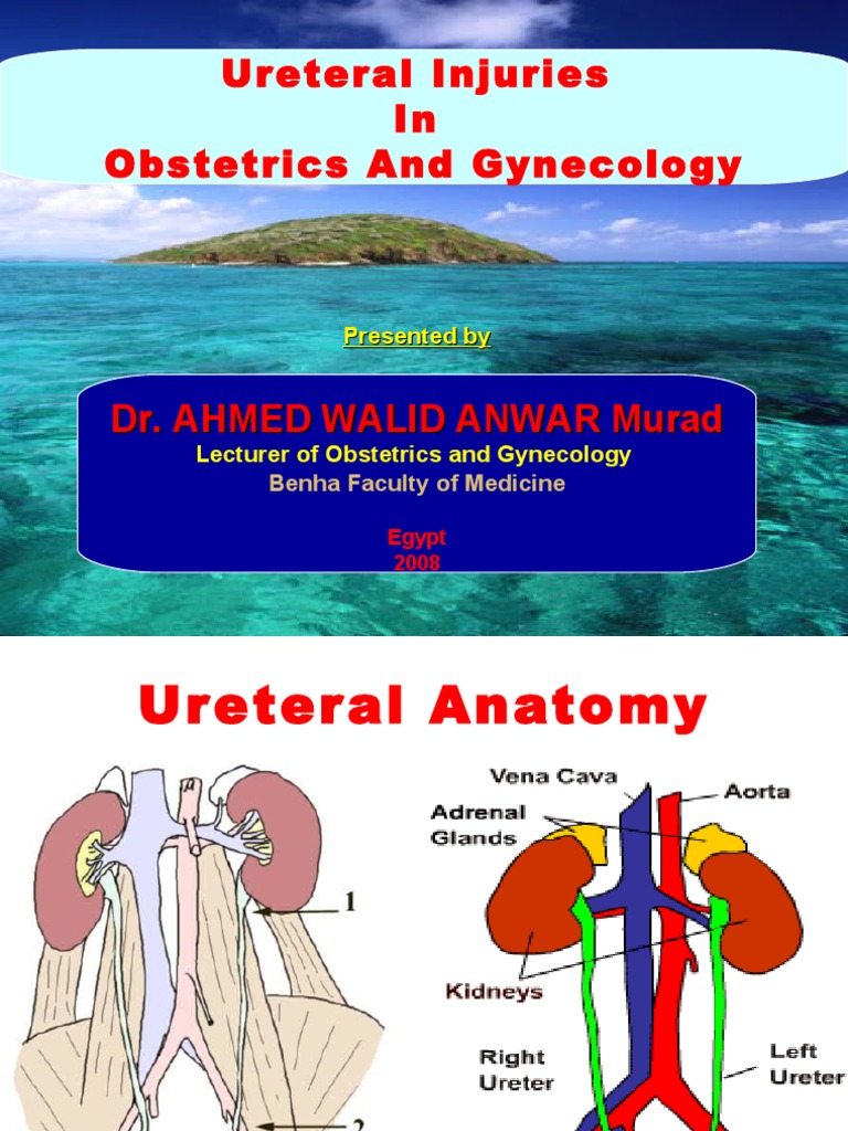 Ureteral Injuries Obgyn-1 | Uterus | Medical Specialties