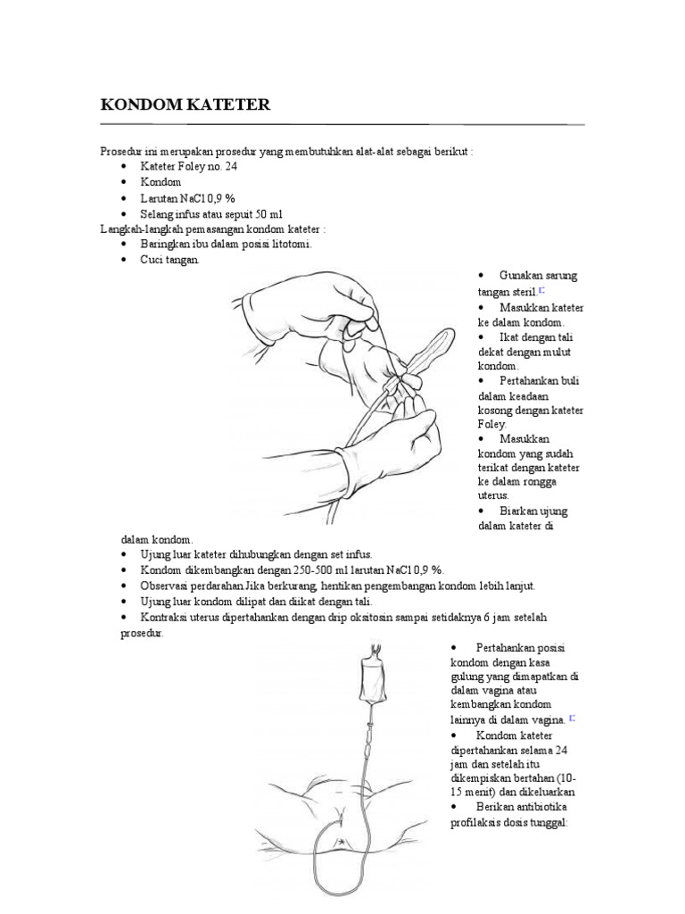 Kondom Kateter | PDF
