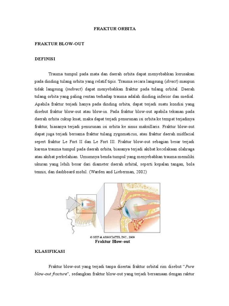 Fraktur Orbita | PDF