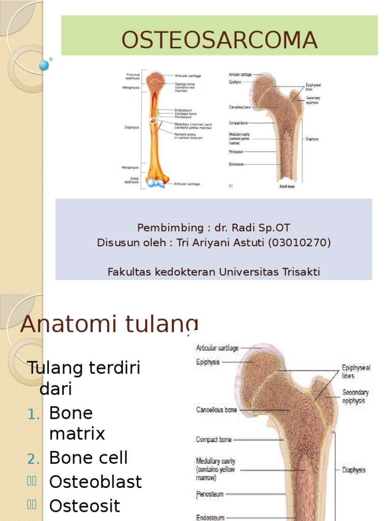 Tri Ariyani (03010270) Osteosarcoma | PDF