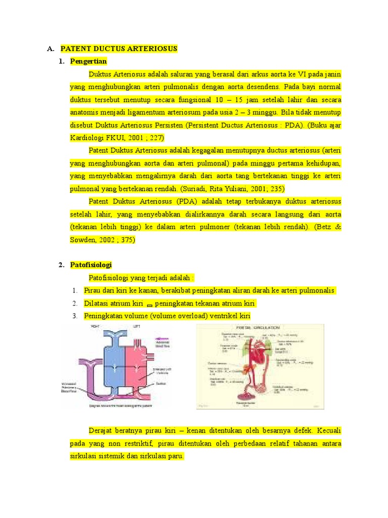 Pemahaman Patent Duktus Arteriosus (PDA) | PDF