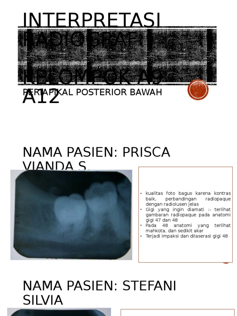 Interpretasi Radiograf Periapikal Posterior Fix | PDF