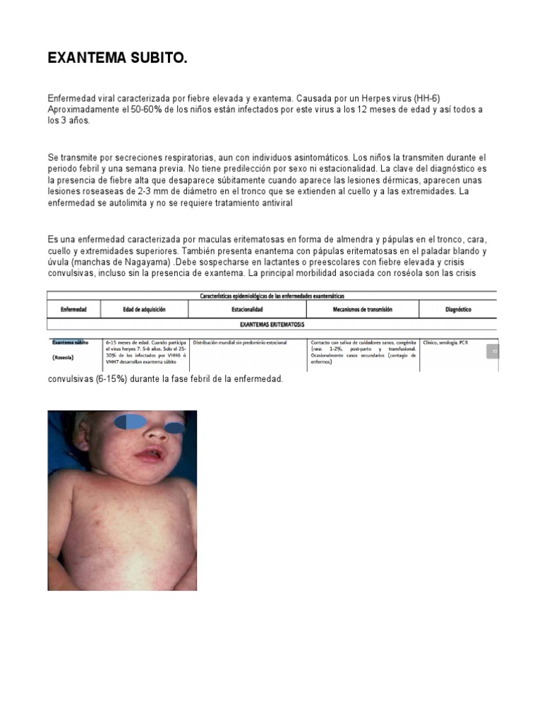 Exantema Subito | PDF