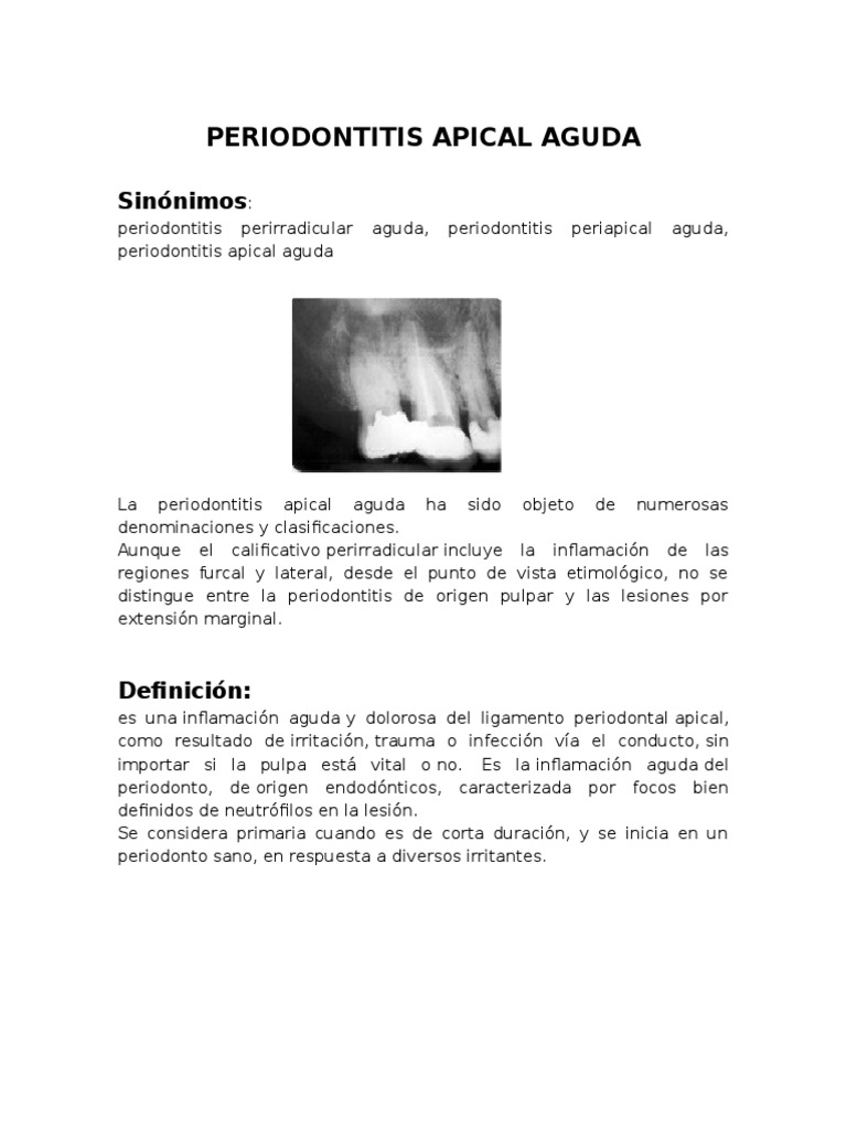 PERIODONTITIS APICAL AGUDA