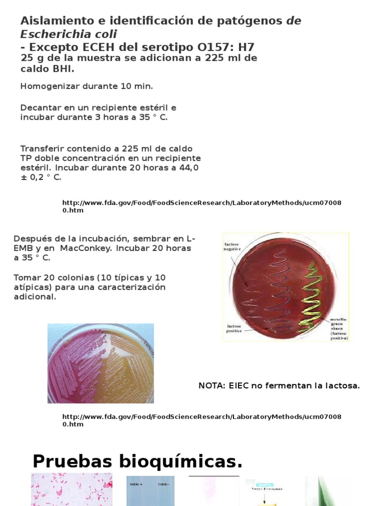 Escherichia coli: Aislamiento e identificación de patógenos de ...