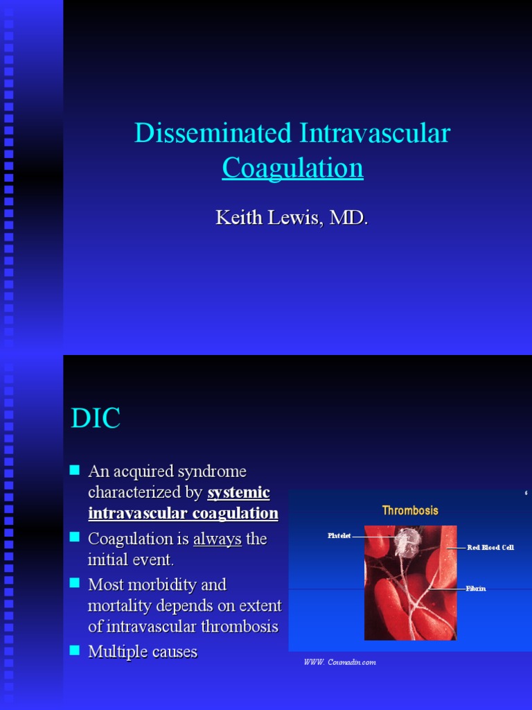 Disseminated Intravascular Coagulation | Coagulation | Platelet