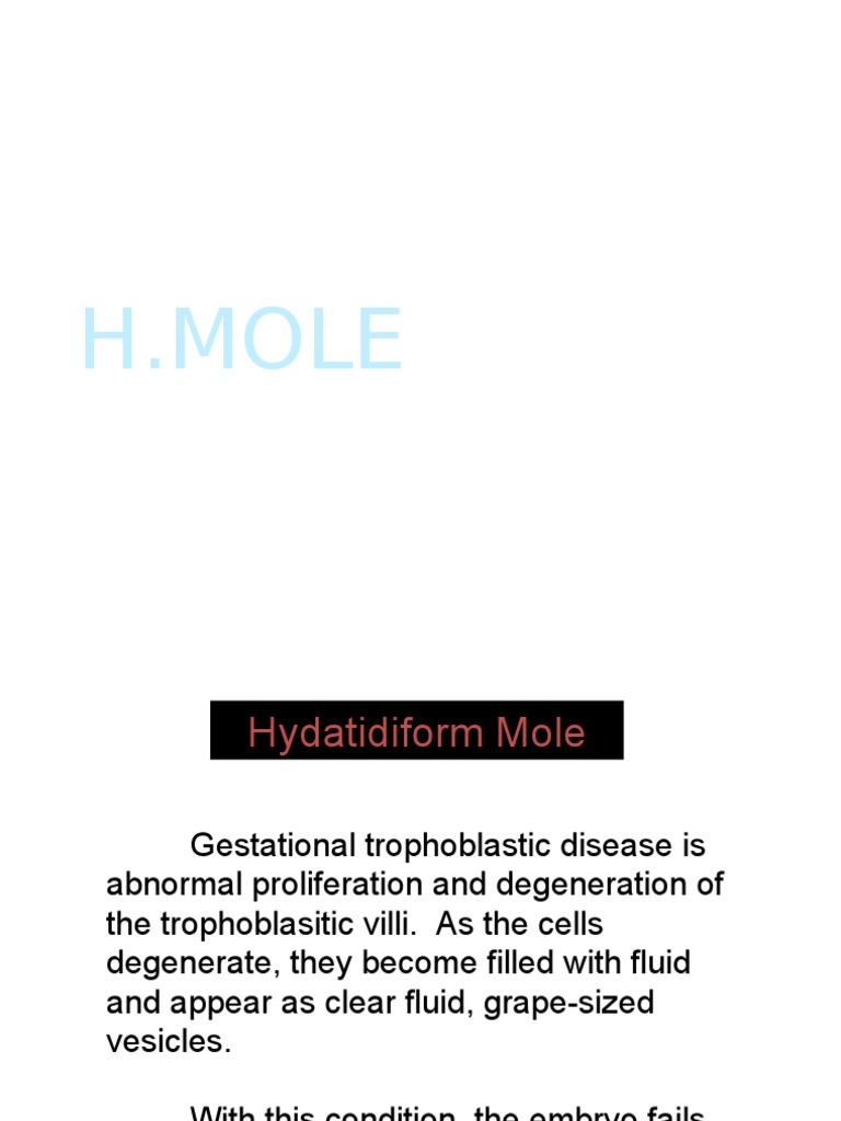 Hydatidiform Mole | PDF | Human Chorionic Gonadotropin | Pregnancy