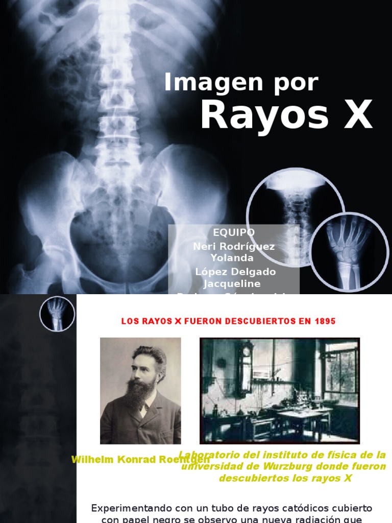 Propiedades y Aplicaciones de Rayos X | PDF | Rayo X | Radiografía