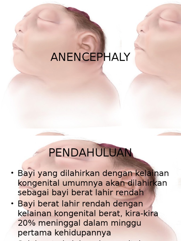 ANENCEPHALY | PDF