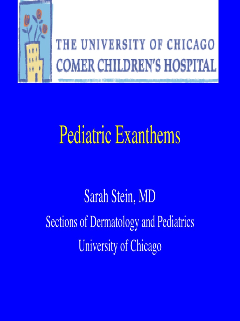 Classic Childhood Exanthems | Measles | Immunology
