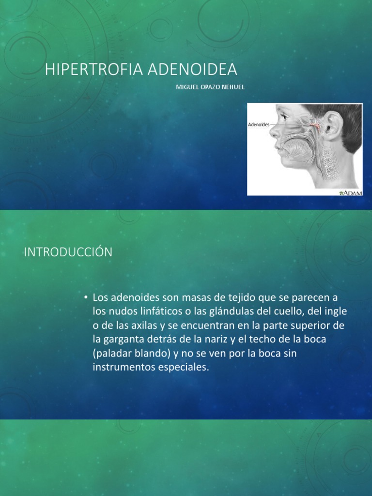 Hipertrofia Adenoidea | PDF | Enfermedades y trastornos | Medicina