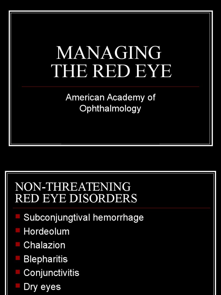 Managing the Red Eye.ppt | Diseases And Disorders | Ophthalmology