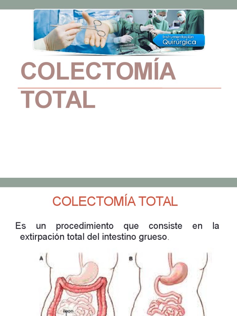 Colectomía Total: Procedimiento y Complicaciones | PDF | Intestino ...