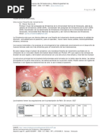 Prescripción de Torque Con Técnica MBT | PDF | Ramas de Odontología
