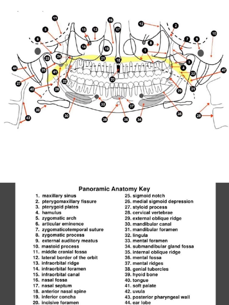 Panoramic Anatomy | PDF