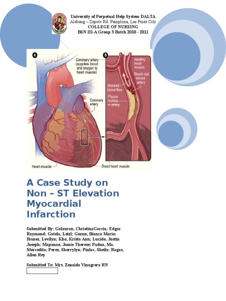 53138046 Case Study NSTEMI | Heart Valve | Myocardial Infarction