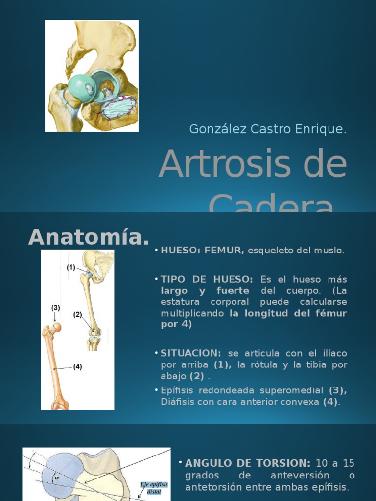 Artrosis de Cadera | Cadera | Anatomía humana