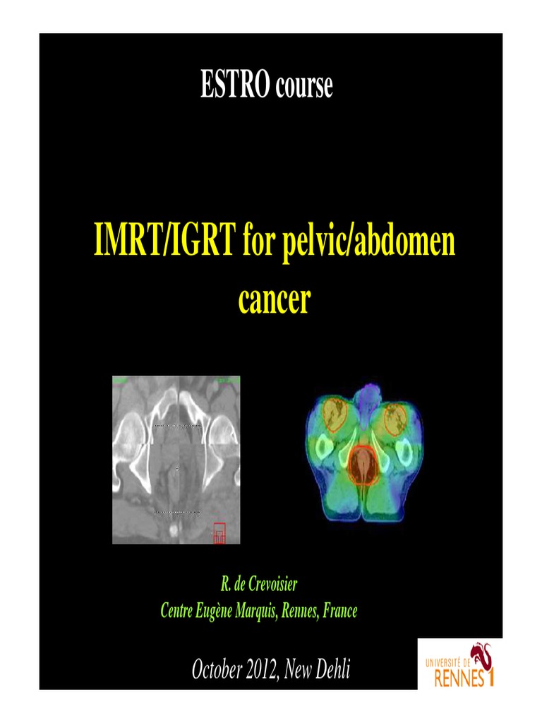 L29 - IMRT and IGRT For Pelvic Abdomen Cancer - de Crevoisier | PDF ...