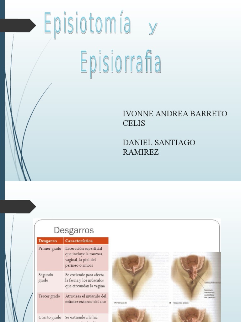 Episiotomia y Episiorafia312 | PDF | Parto | Pelvis