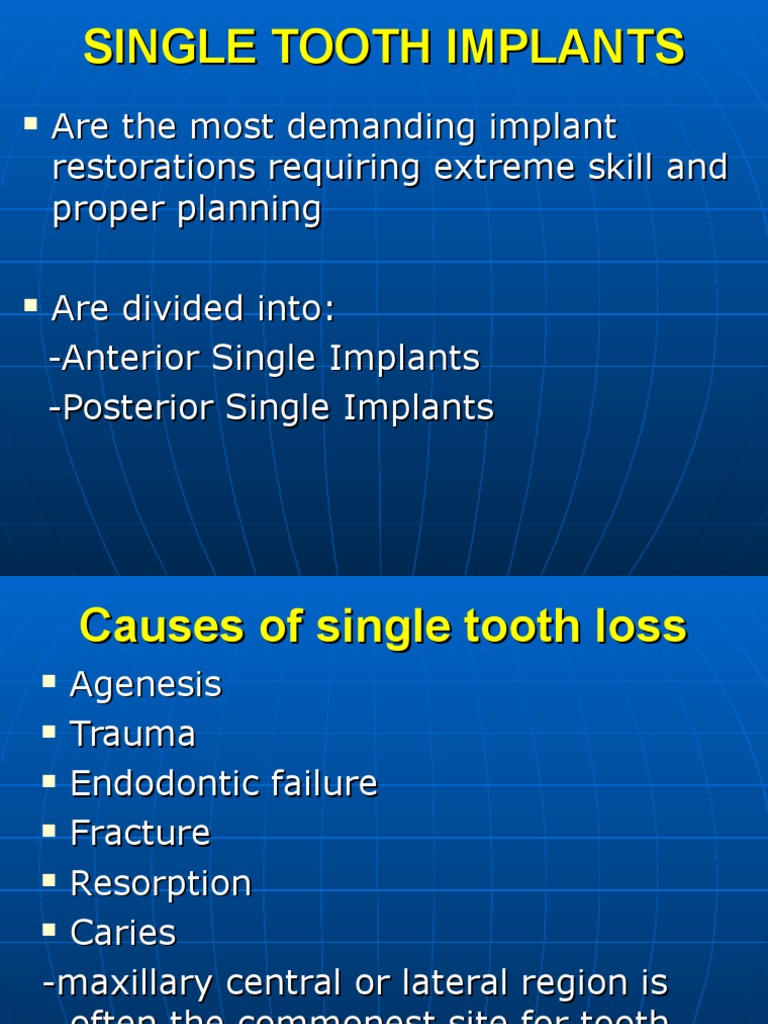 Single Tooth Implant Overview | PDF | Dental Implant | Mouth