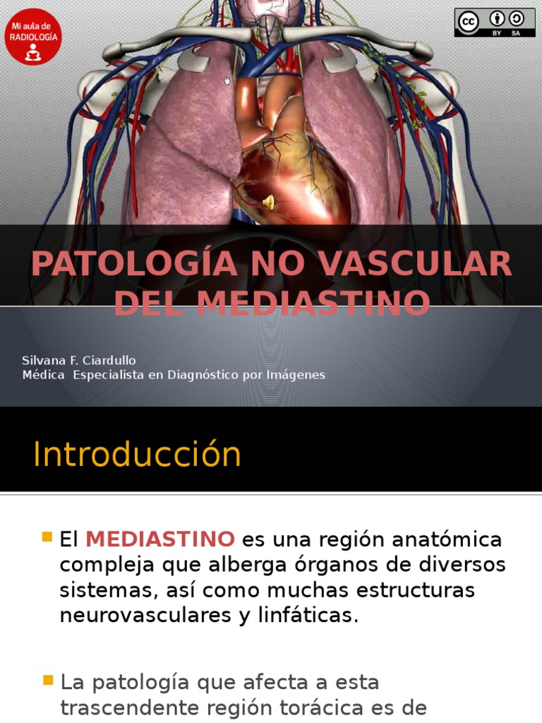 Diagnóstico de Las Masas Mediastinales | PDF | Anatomía | Especialidades Medicas