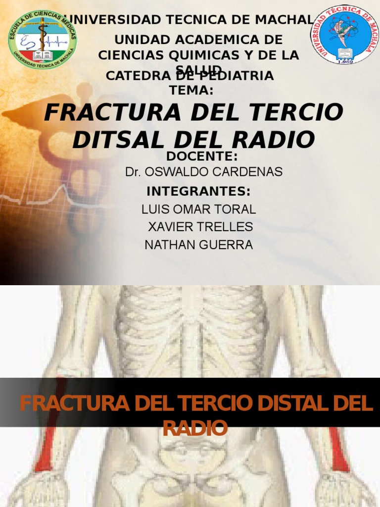 Fractura Distal del Radio: Clasificación y Tratamiento | PDF