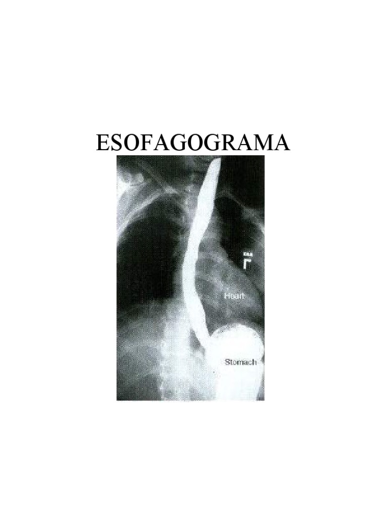 Esofagograma | PDF | Bem-estar | Ciências e Matemática