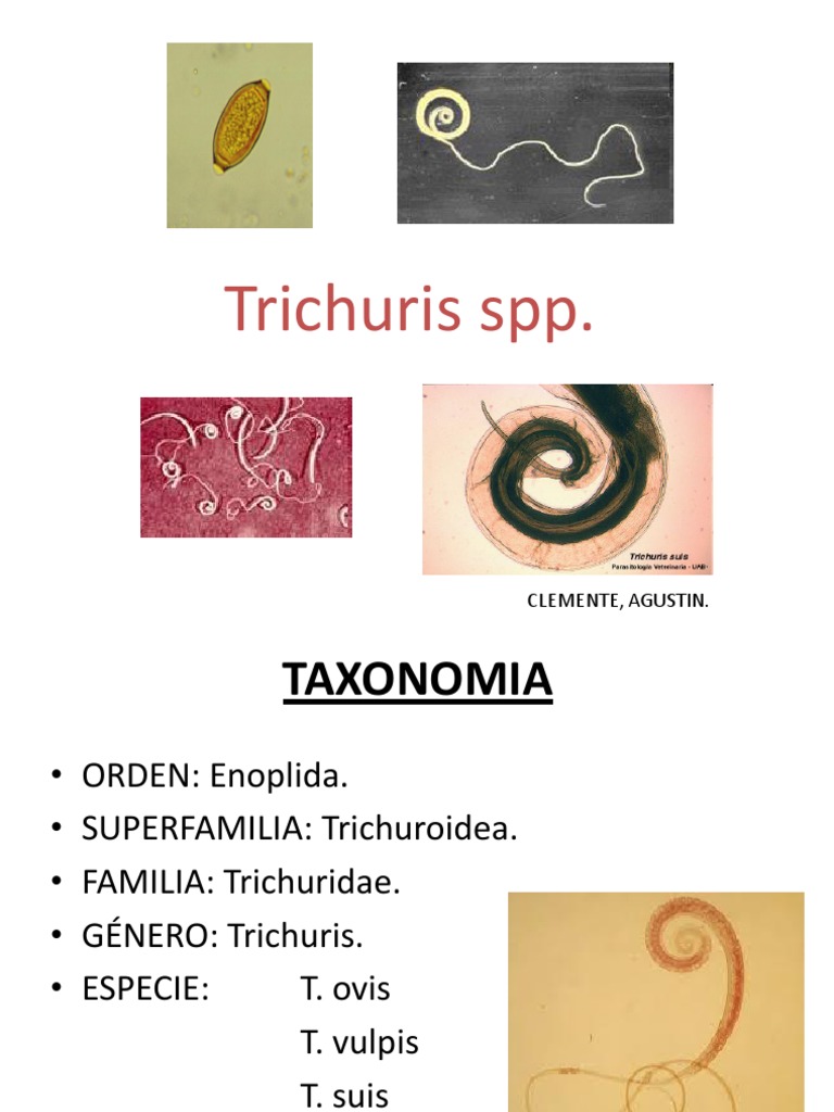 Trichuris Spp 2015
