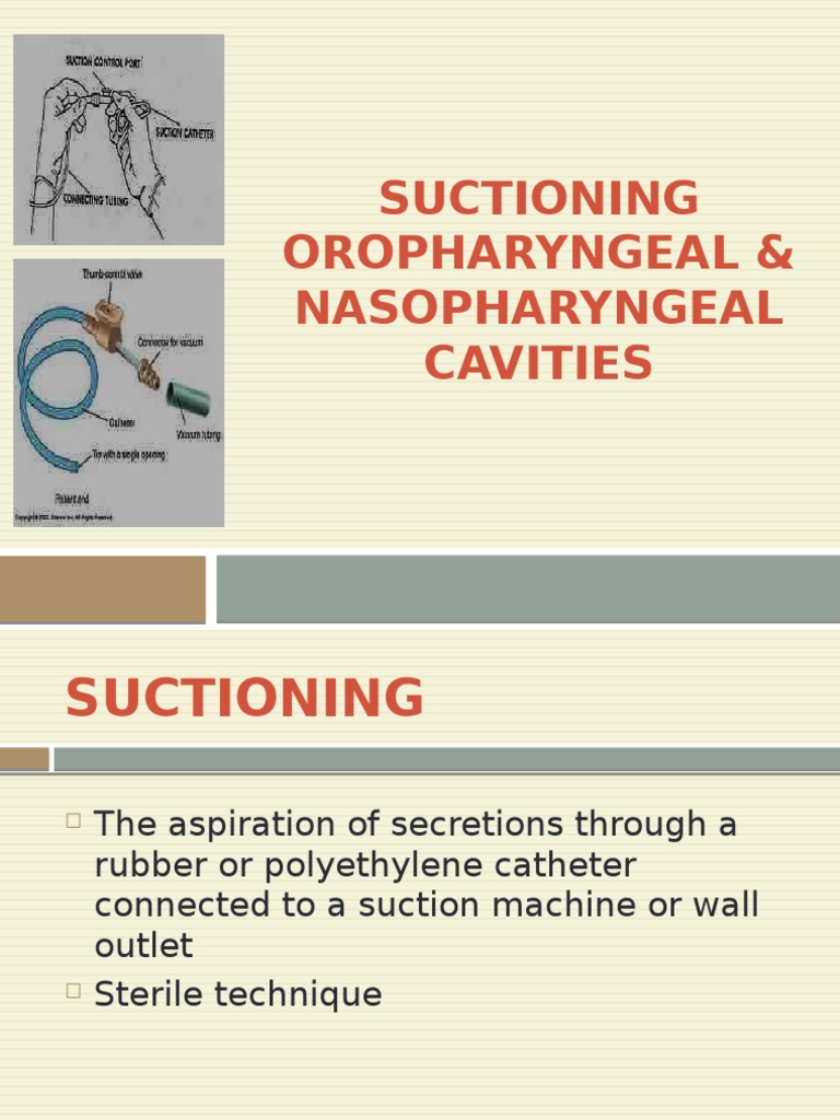 Suctioning | Catheter | Respiratory Tract