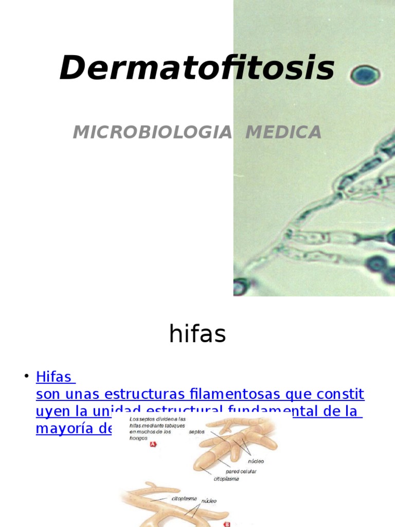 dermatofitosis (1) | Microbiología | Dermatología