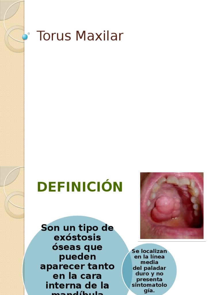 Torus Maxilar: Definición y Tratamiento | PDF | Dentadura postiza ...