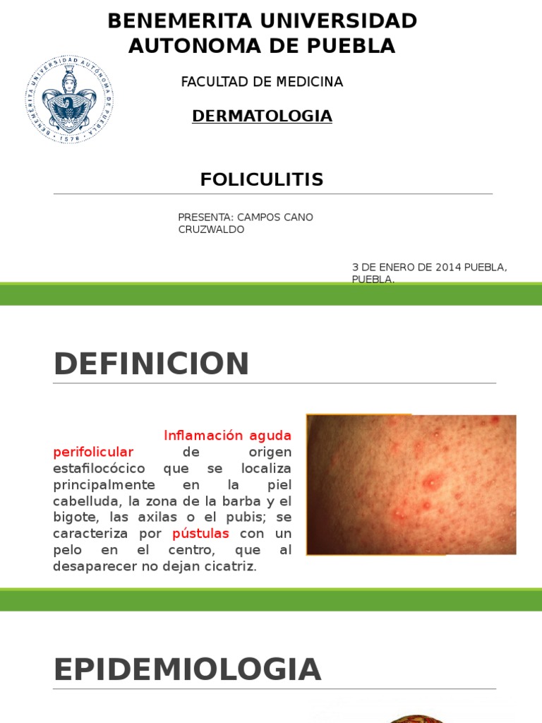 FOLICULITIS | Dermatología | Enfermedades y trastornos | Prueba ...