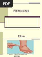 TEMA 8 Valoración Del Edema | PDF | Edema | Especialidades Medicas