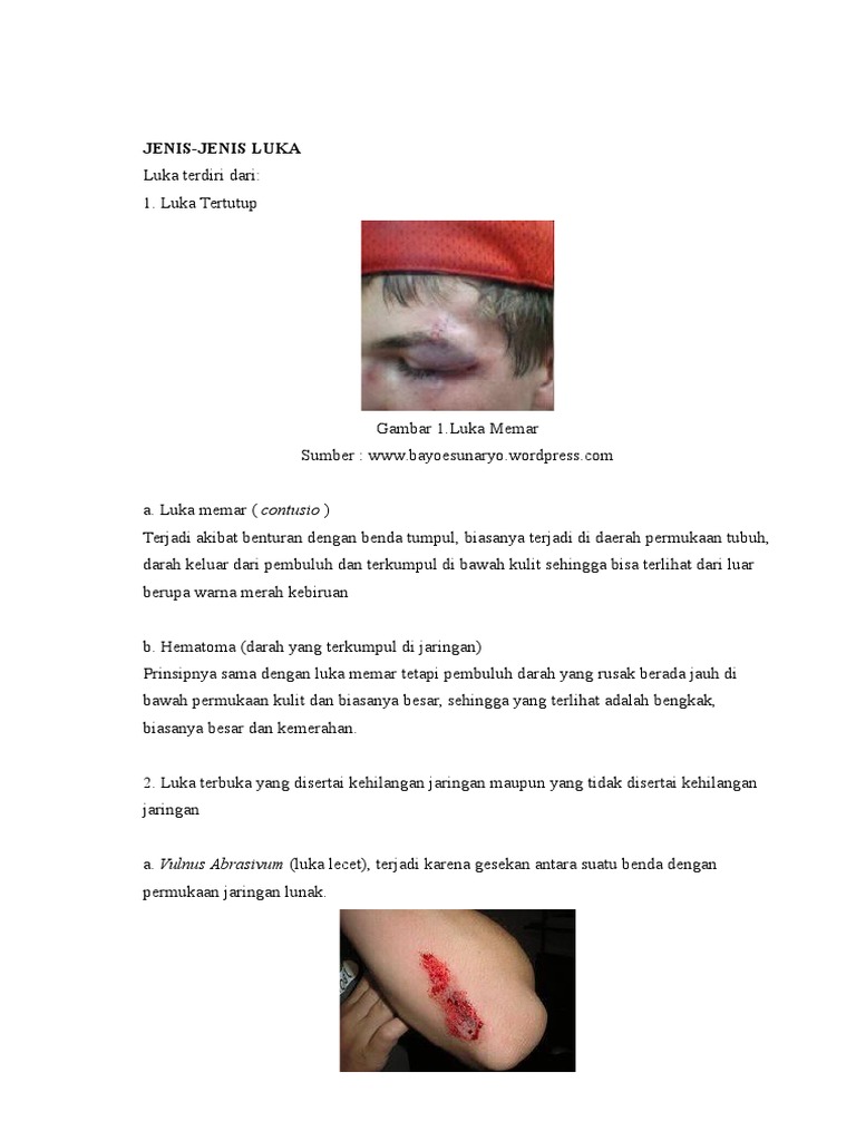 Revisi Jenis Luka | PDF