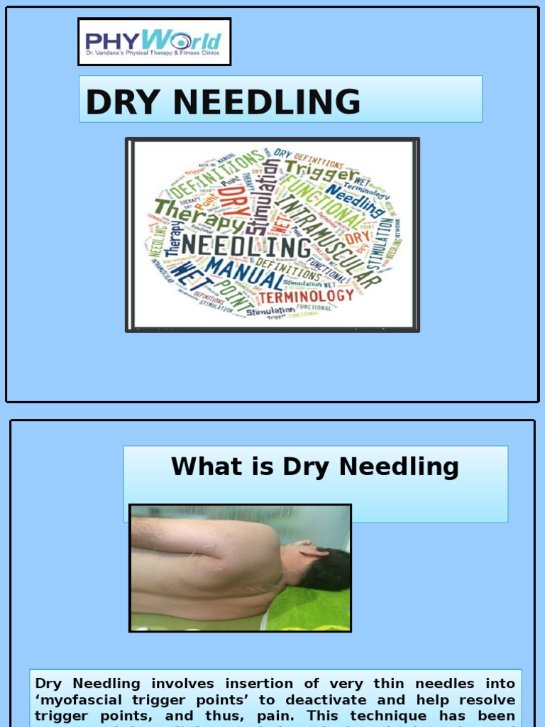 Dry Needling | PDF | Myofascial Trigger Point | Acupuncture