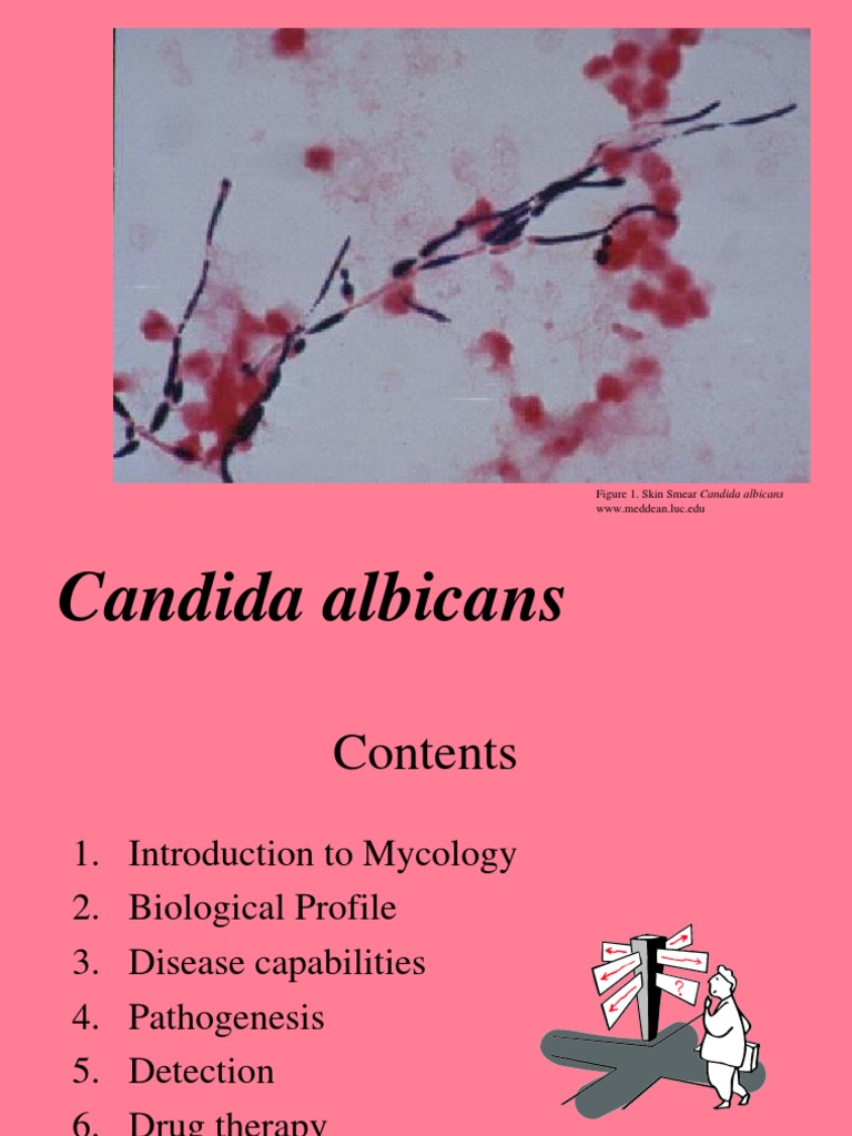 Candida Albicans: Figure 1. Skin Smear Candida Albicans WWW - Meddean ...