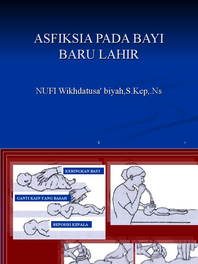 Asfiksia Pada Bayi Baru Lahir | PDF | Kesehatan Holistik Asfiksia Pada Bayi Baru Lahir | PDF | Kesehatan Holistik